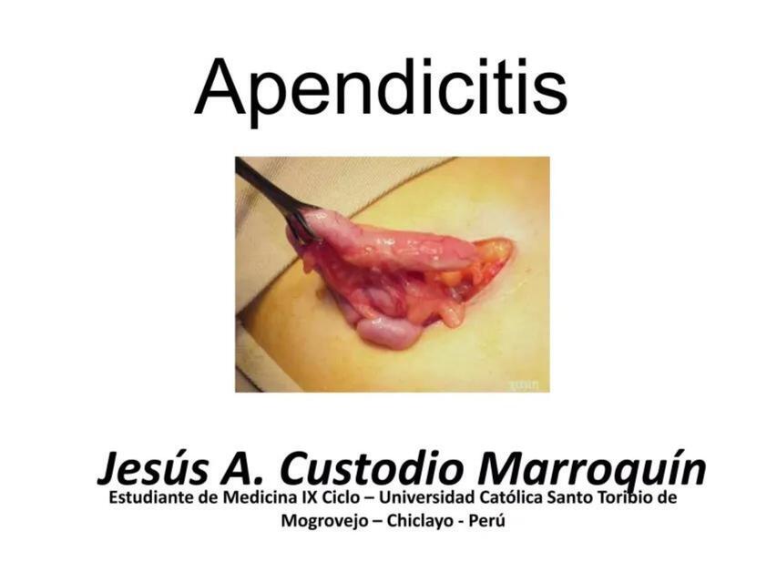 Apendicitis | Movie | uDocz