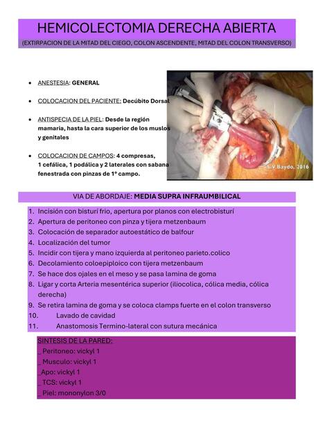 tecnica quirurgica | uDocz