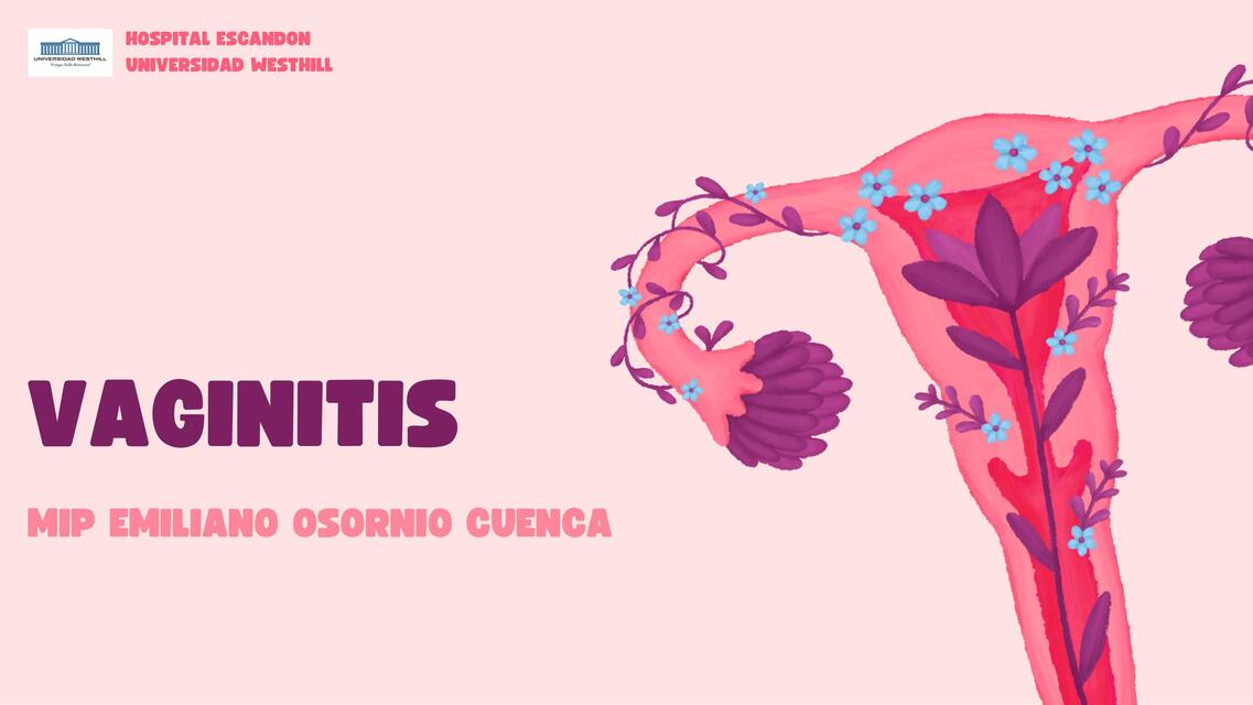 Vaginitis_Gpc | Medicina Fácil | uDocz