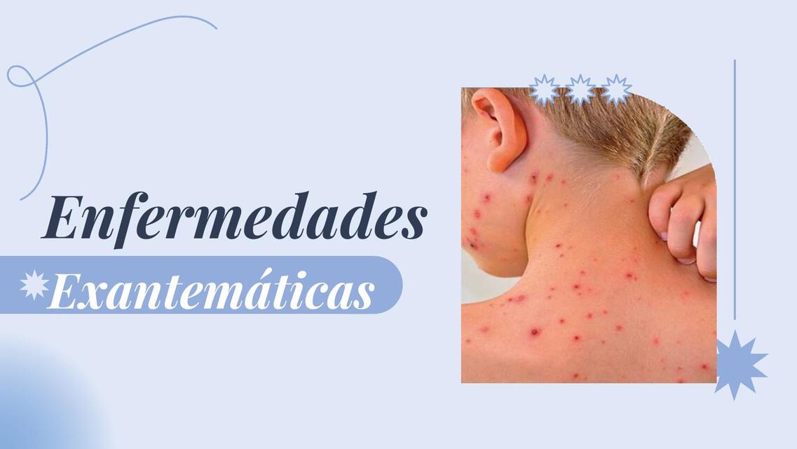 Enfermedades exantematicas | Ava del Angel | uDocz