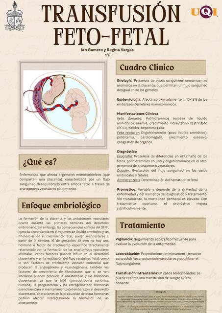 Transfusión feto fetal | Regina Vargas | uDocz