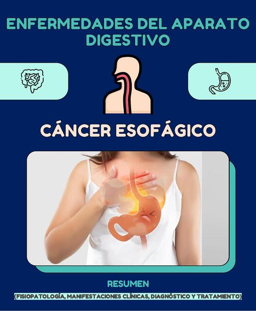 Cáncer esofágico | Javier Rios | uDocz