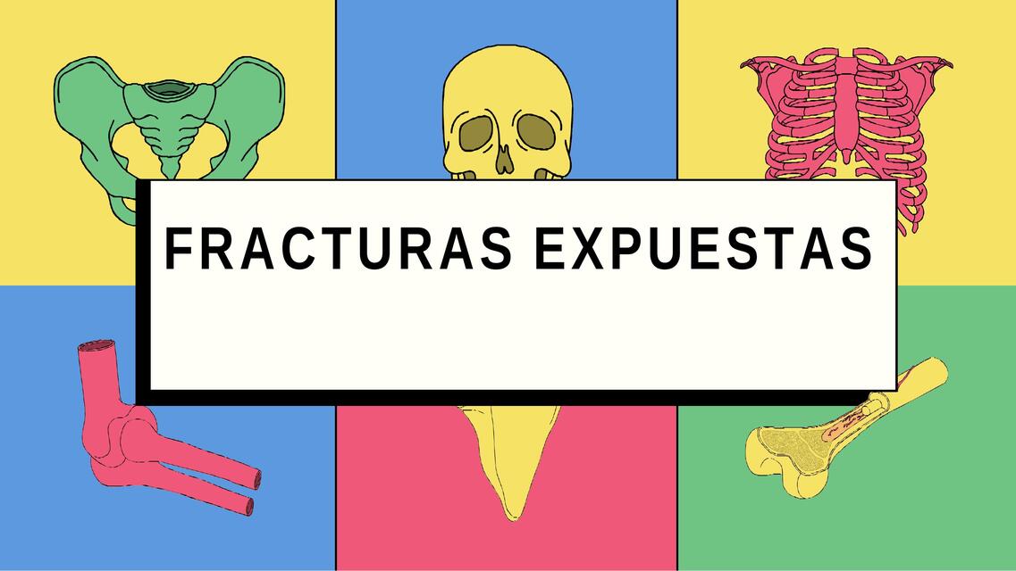 Fracturas expuestas | Laura | uDocz
