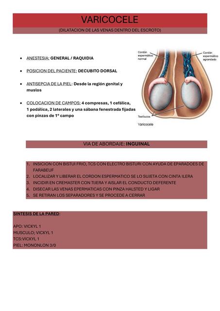 Tecnica Quirugica: VARICOCELE | Dina llanos | uDocz