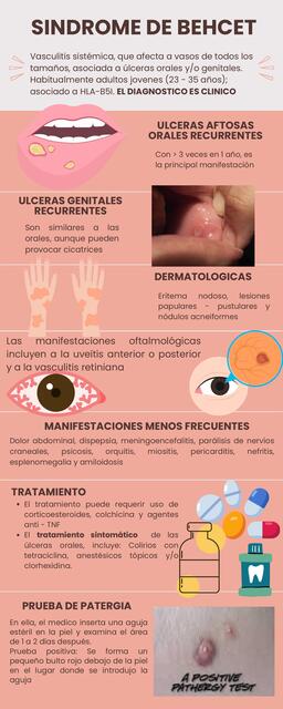 SINDROME DE BEHCET | Medi-miau-notes_Key | uDocz