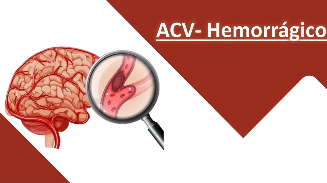 acv hemorragico | A | uDocz