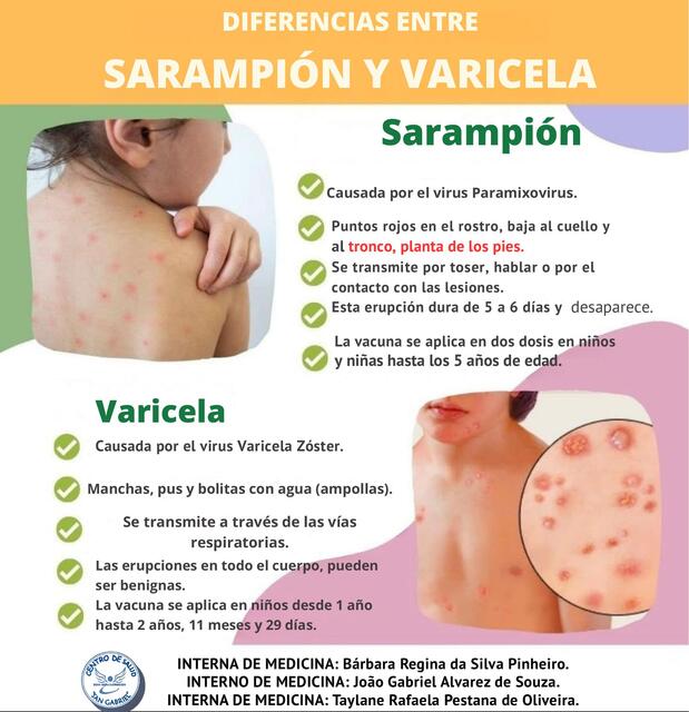Diferencias Entre Sarampión Y Varicela Sarampión C Bárbara Pinheiro