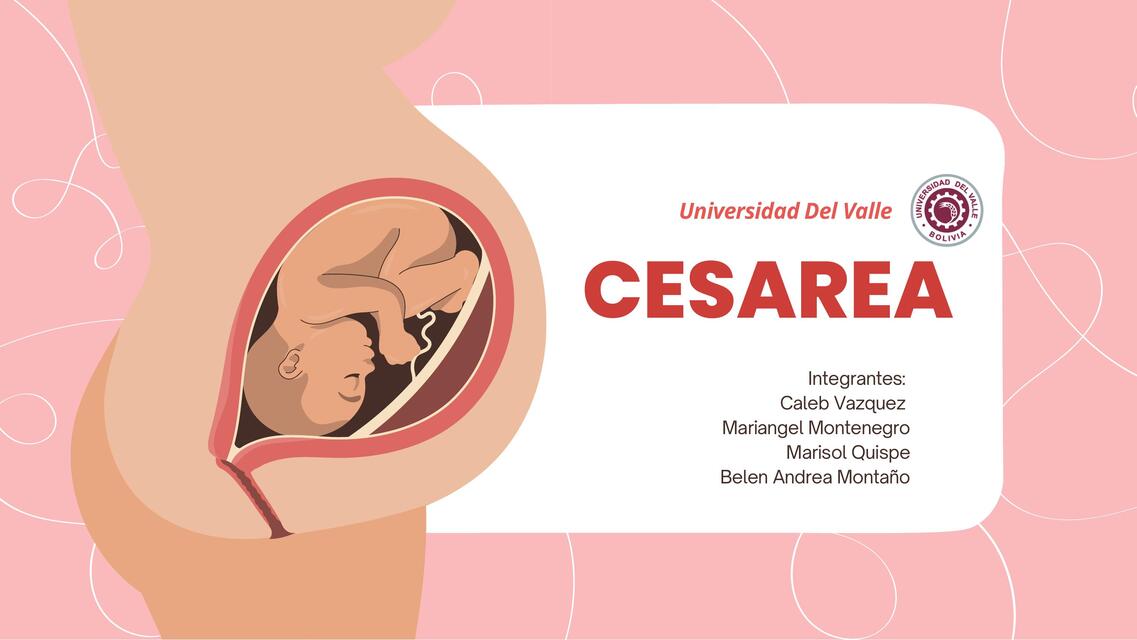 Cesárea Técnica quirúrgica | Belén Andrea | uDocz