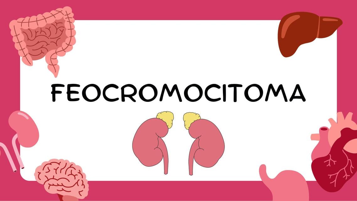 Feocromocitoma | PEDRO AGUSTIN | uDocz