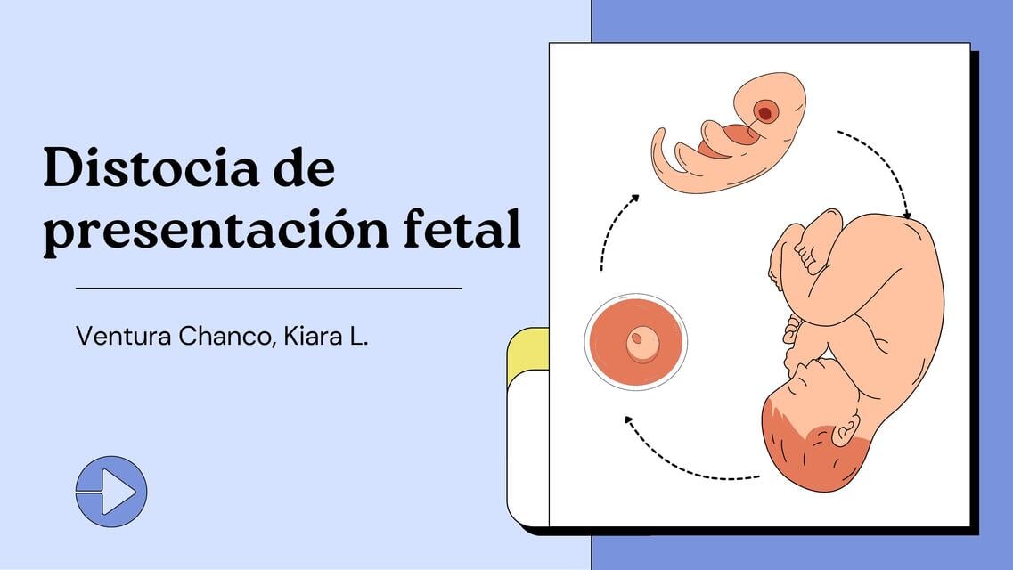 Distocia de presentación fetal | Kiara Ventura | uDocz