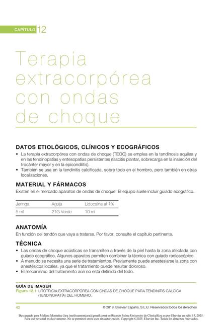 12 Terapia extracorpórea con ondas de choque | Irvin daniel Moron moran ...