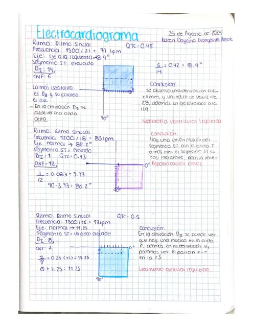 Electrocardiograma 2 Evangelista Arevalo Karen Day | KAREN DAYANA EVANGELISTA AREVALO | uDocz
