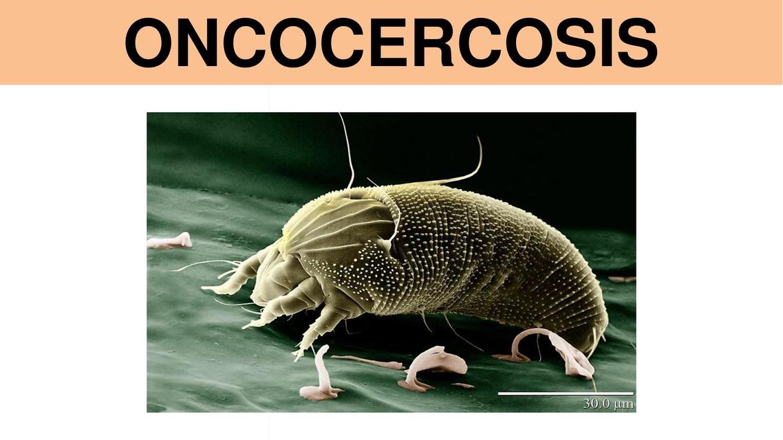 ONCOCERCOSIS | RESÚMENES MÉDICOS | uDocz