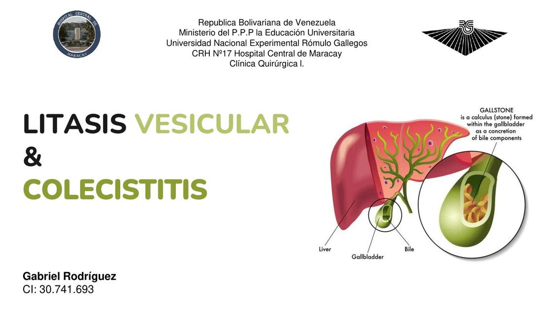 Litiasis vesicular y patologias de las vias biliar | Gabriel | uDocz