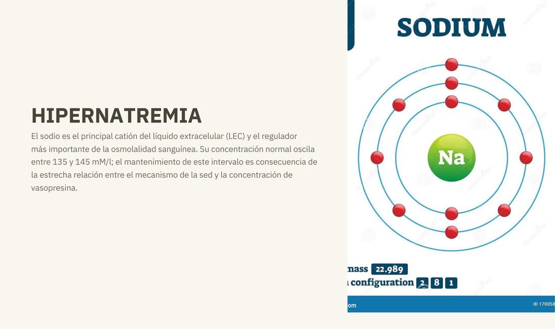 HIPERNATREMIA | Rebeca Benitez Montenegro | uDocz