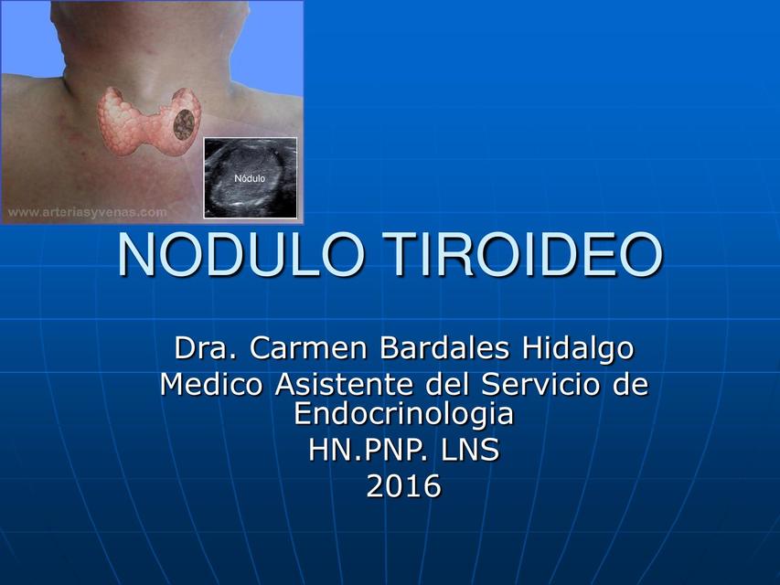Flashcards de Nódulo Tiroideo | Por Ahmed Casana | uDocz