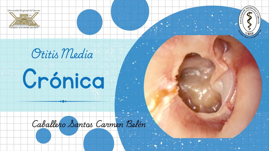Otitis Media Crónica | Carmen Caballero | uDocz