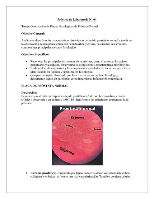 PROSTATA NORMAL | Marcela Varela | uDocz