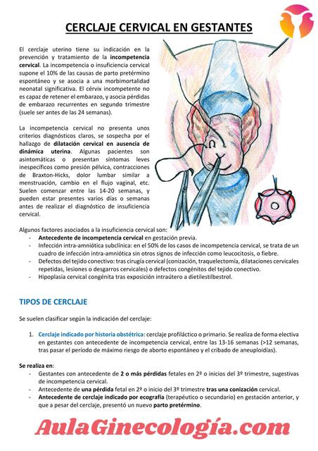 CERCLAJE CERVICAL EN GESTANTES | Levis | uDocz