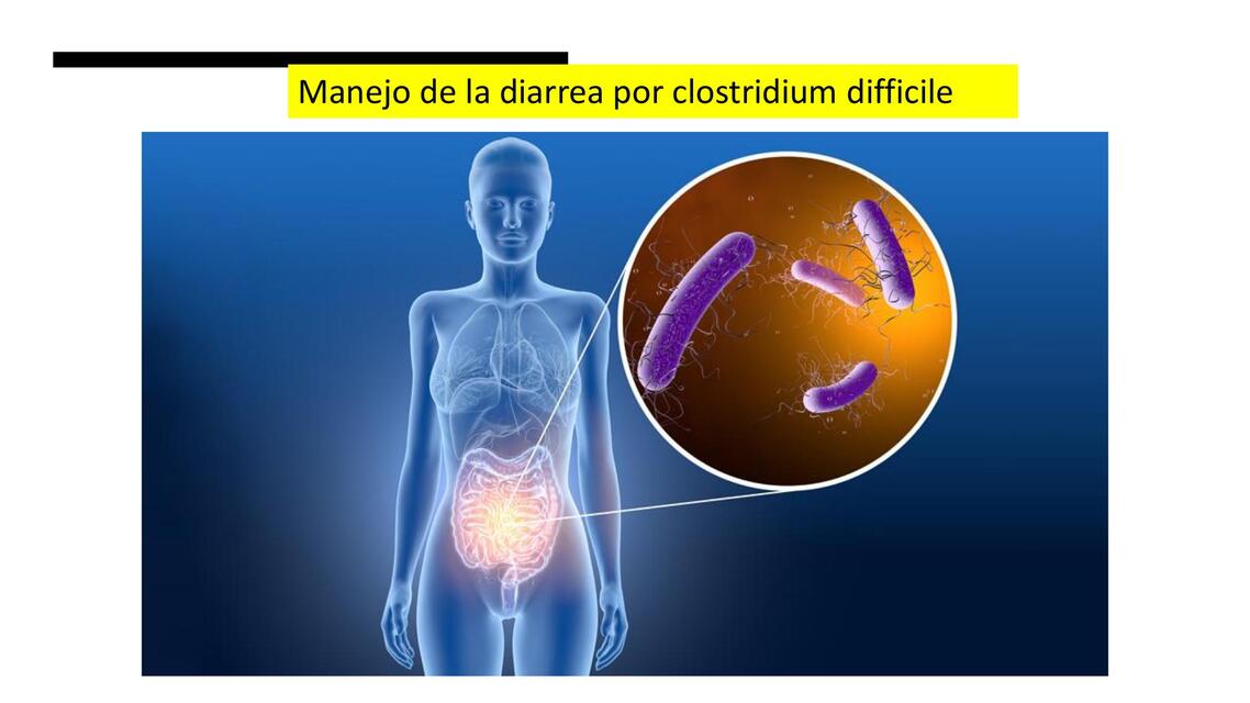 manejo diarrea x clostridium difficile | Gavreel | uDocz