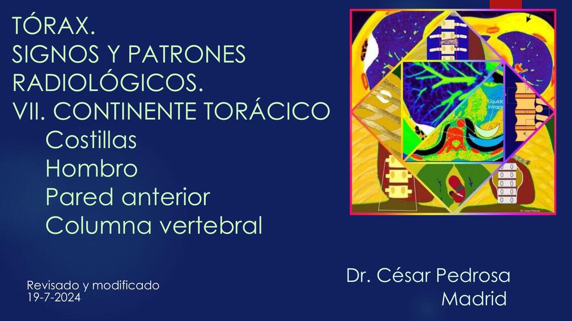 Tórax signos y patrones radiológicos | Medicina General 1 | uDocz