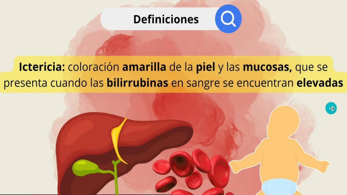 Ictericia nenatal | Oswaldo Armas | uDocz