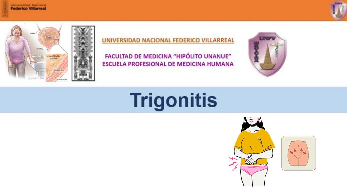 Flashcards de trigonitis urologiaaa | Por maxi lopez | uDocz