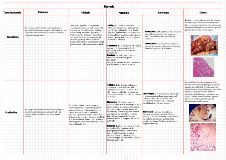 Necrosis “tipos” | Shirley Dayana Rueda Moncada | uDocz