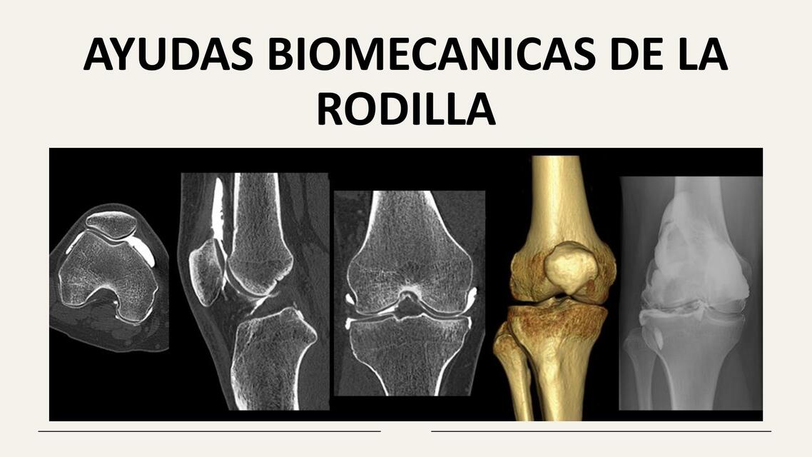 AYUDAS BIOMECANICAS DE LA RODILLA | Ingri Tello | uDocz
