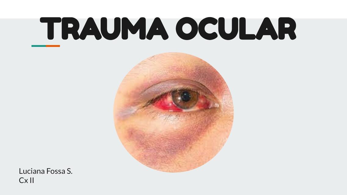 Trauma ocular- Cx II | Luciana | uDocz