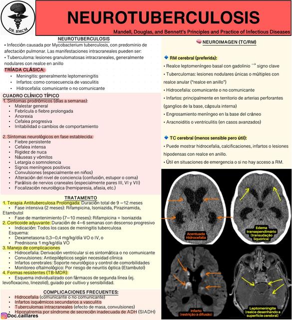 NEUROTUBERCULOSIS | Dr. Boris Moises Caillares Montaño | uDocz