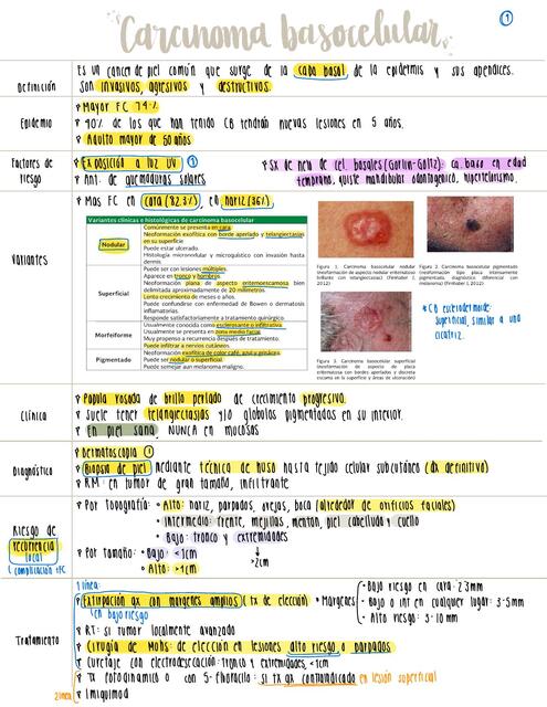 Carcinoma basocelular gpc | Josefa (@jomedstudent) | uDocz
