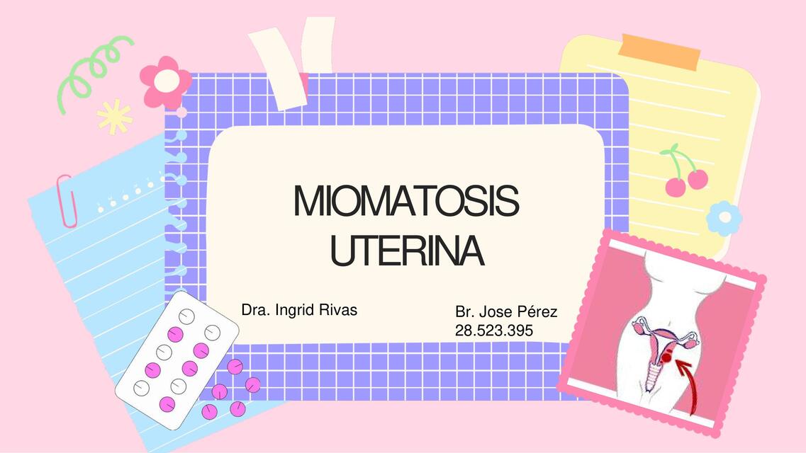Miomatosis Uterina | Salvatore Melillo | uDocz