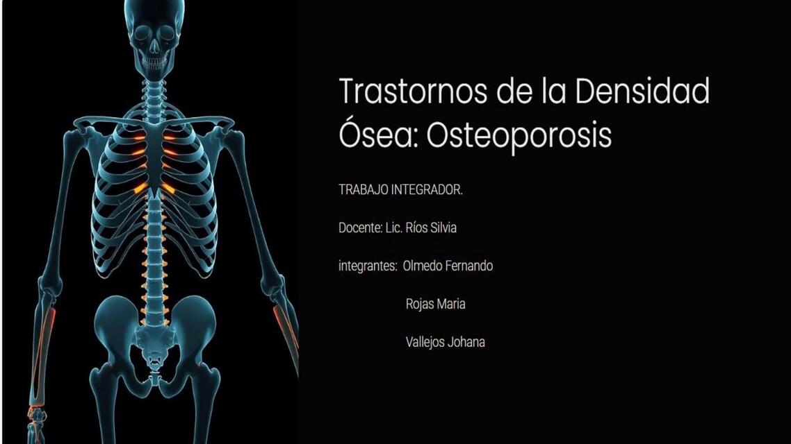 OSTEOPOROSIS | Maria Rojas | uDocz