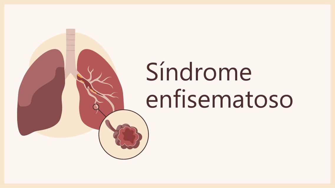 enfisema pulmonar | Manuel de Jesús Clara Cordero | uDocz