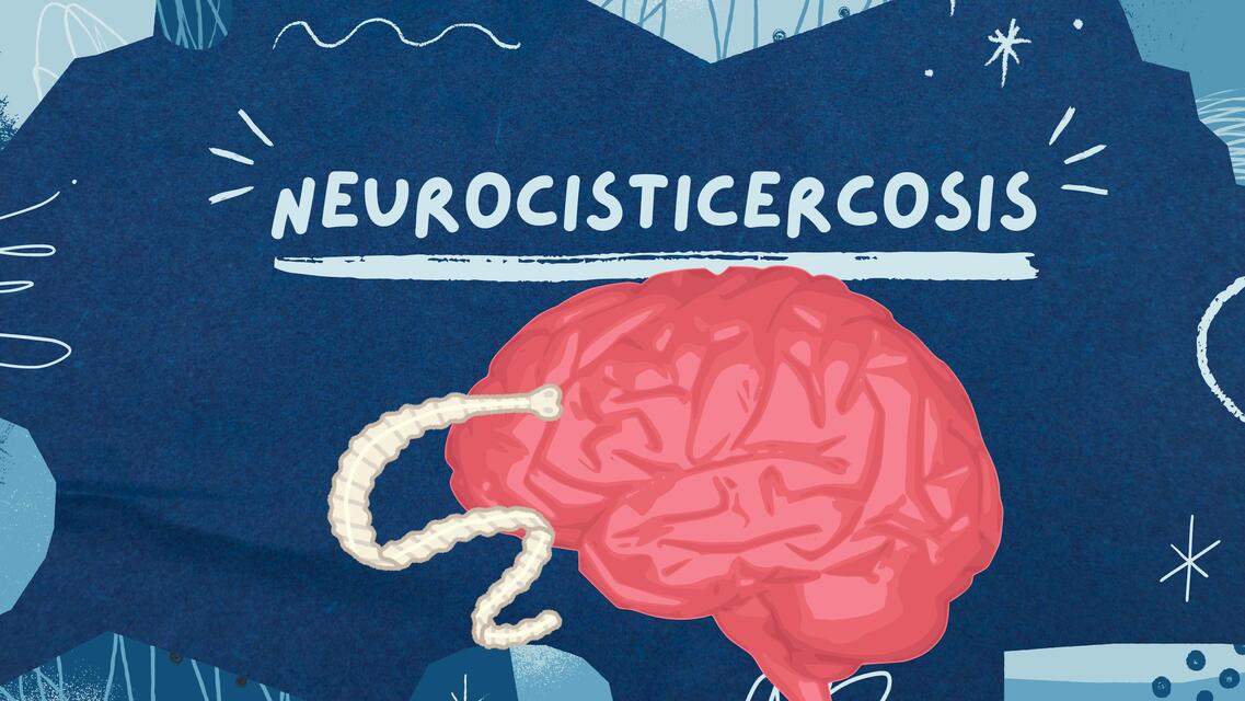 Neurocisticercosis | Dulce María | uDocz