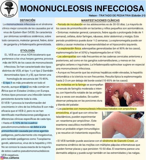MONONUCLEOSIS INFECCIOSA | Dr. Boris Moises Caillares Montaño | uDocz