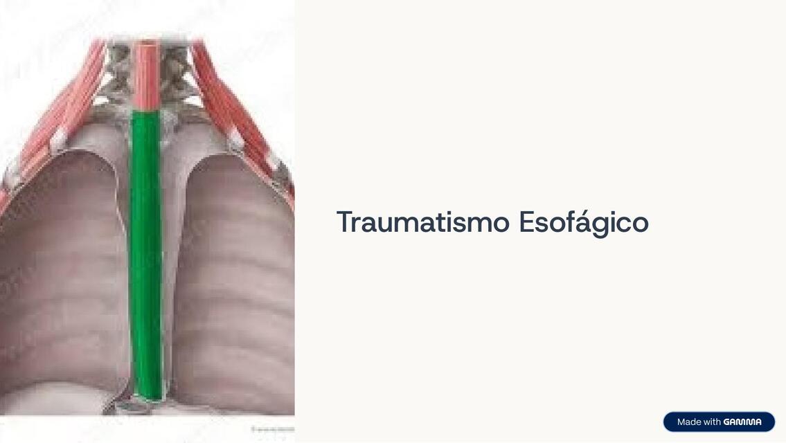 Traumatismo Esofagico | Daniel | uDocz