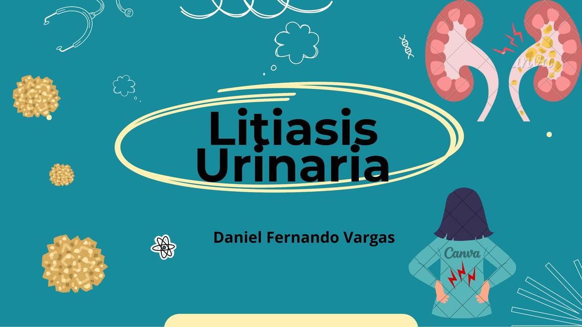 Urolitiasis Daniel Vargas | Danny | uDocz