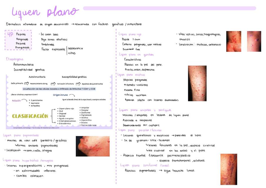 liquen plano | Joseline Carrreola | uDocz