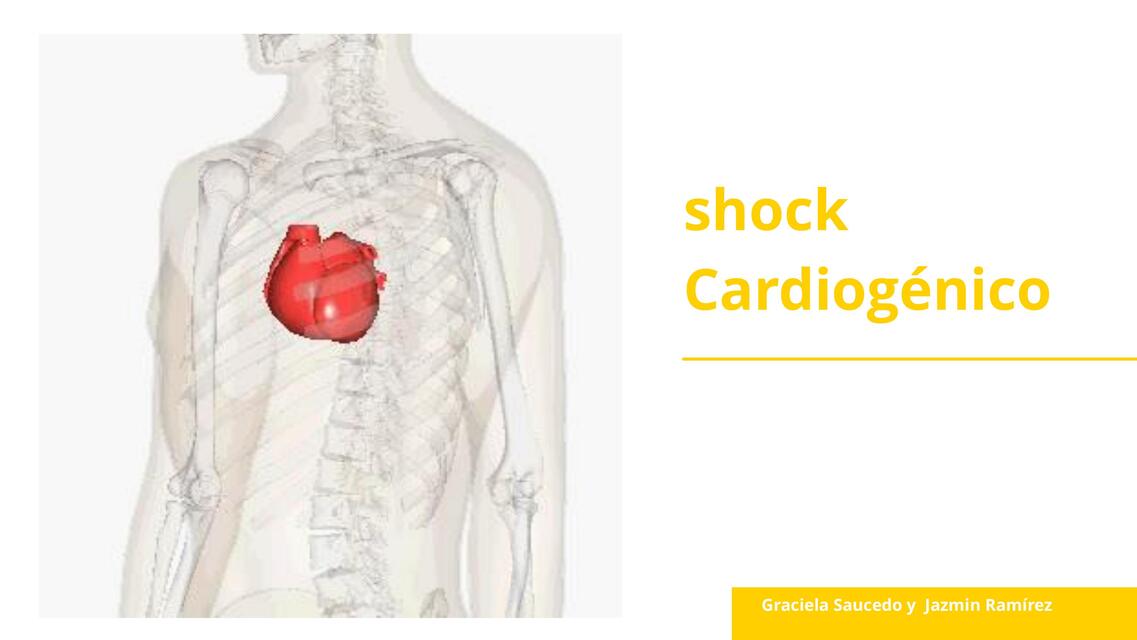 Shock Cardiogénico Jazmin y Graciela | Azucena | uDocz