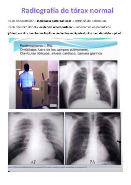 rx de torax normal | Micaela Godoy Graziano | uDocz