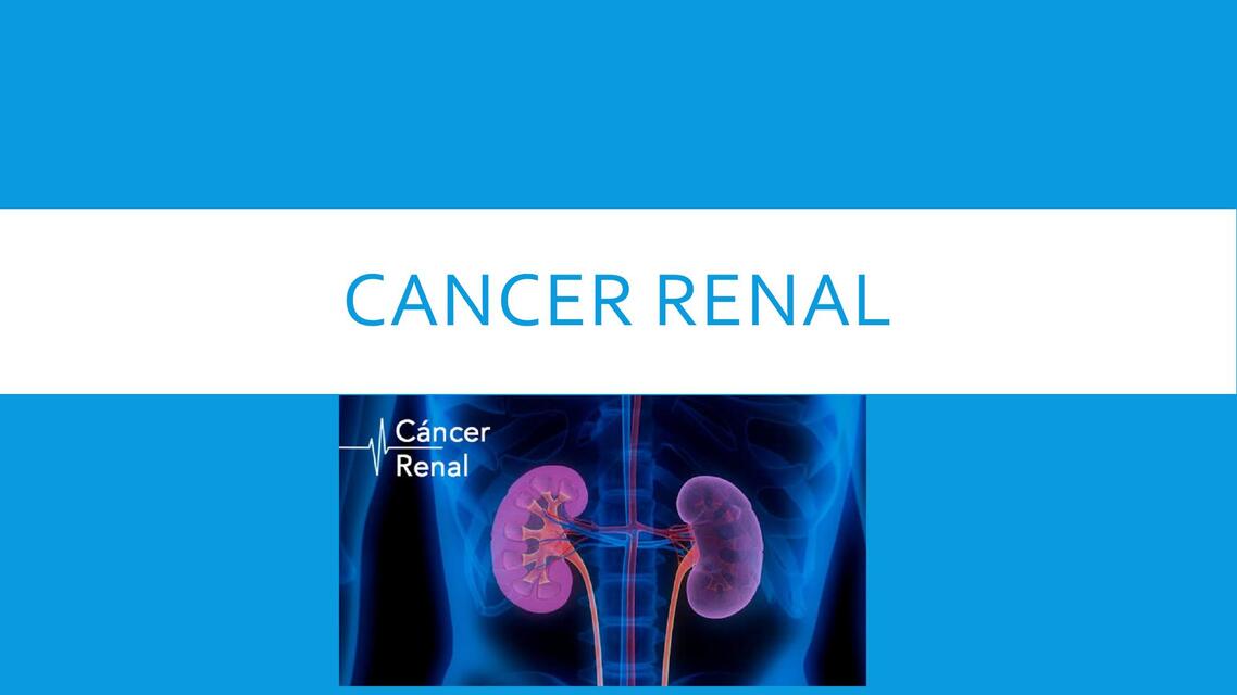 CANCER RENAL | Julian | uDocz