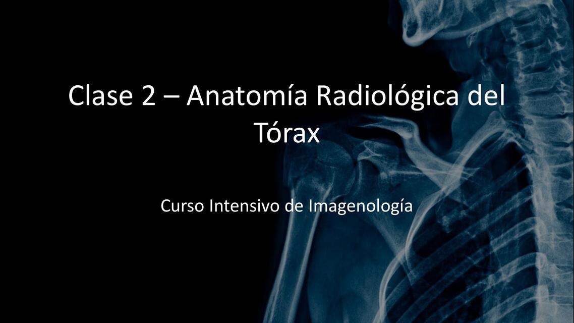 imagenologia de torax | José | uDocz