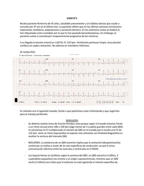 CASOS ECG | Mario Jesus | uDocz