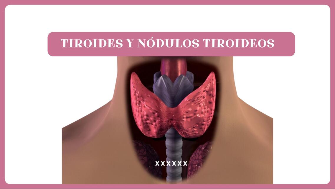 TIROIDES Y NÓDULOS TIROIDEOS | Maria Monica | uDocz