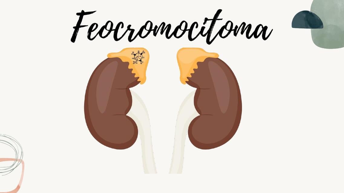 Feocromocitoma diagnostico y tratamiento | Mednotes | uDocz