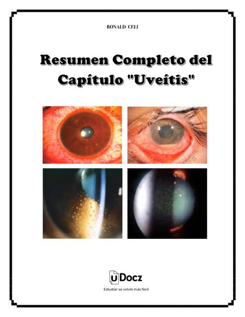Resumen Uveitis kanski | Ronald | uDocz