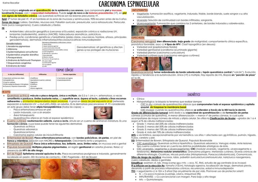 CARCINOMA ESPINOCELULAR | Karine Bacellar | uDocz