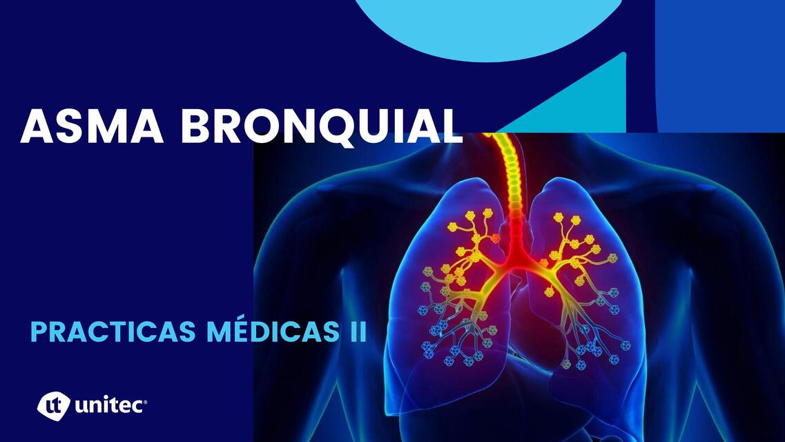 ASMA BRONQUIAL | Ariel Faustino González Quintero | uDocz